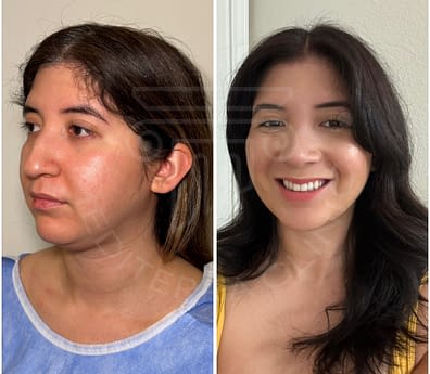 European Board Certified Plastic Surgery in Istanbul - The Best Plastic ...