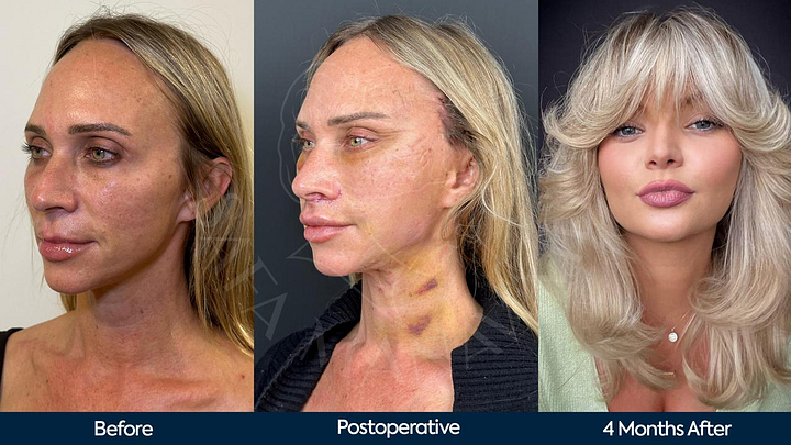 2025 European Board Certified Plastic Surgery in Istanbul - The Best ...