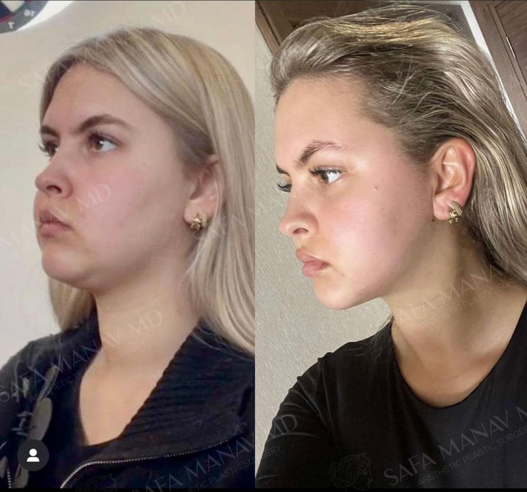 Plastic Surgery - Safa Manav MD